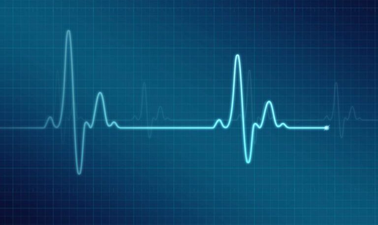 The Case for Cardiac Telemetry in Post-Acute Care Facilities - Vios Medical